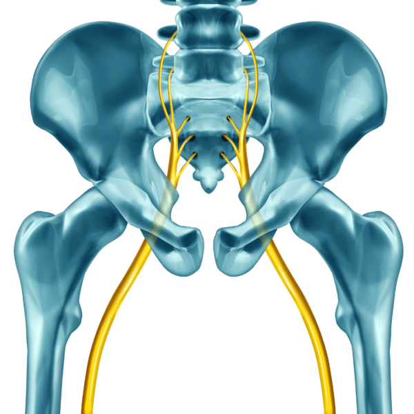 Understanding the Correlation Between Scoliosis and Sciatica – Denver