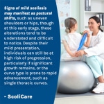 Mild Scoliosis: Symptoms and Effective Treatment Options – ScoliCare